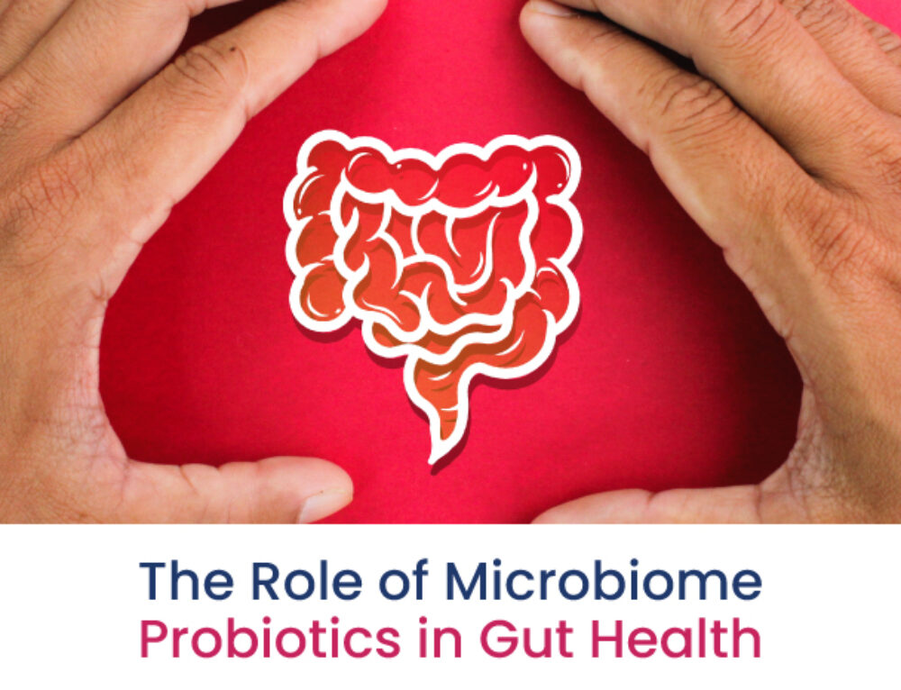 Probiotic Selection: Choosing the Right Kind | Biom Probiotics