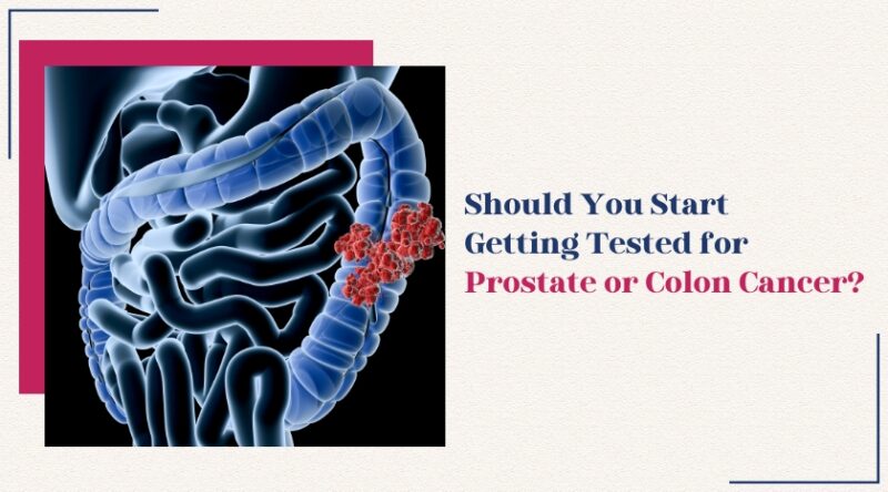Prostate & Colon Cancer Testing: When to Start | Biom Probiotics