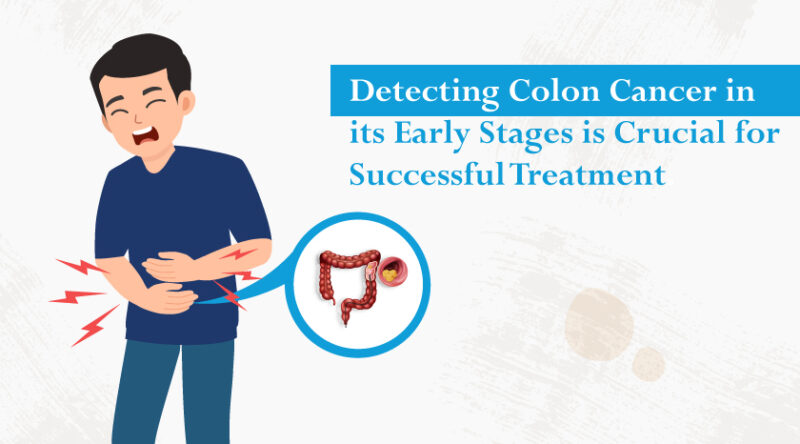 Early detection vital for treating colon cancer | Biom Probiotics