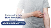 How Probiotics Alleviate Atopic Dermatitis - Biom Probiotics